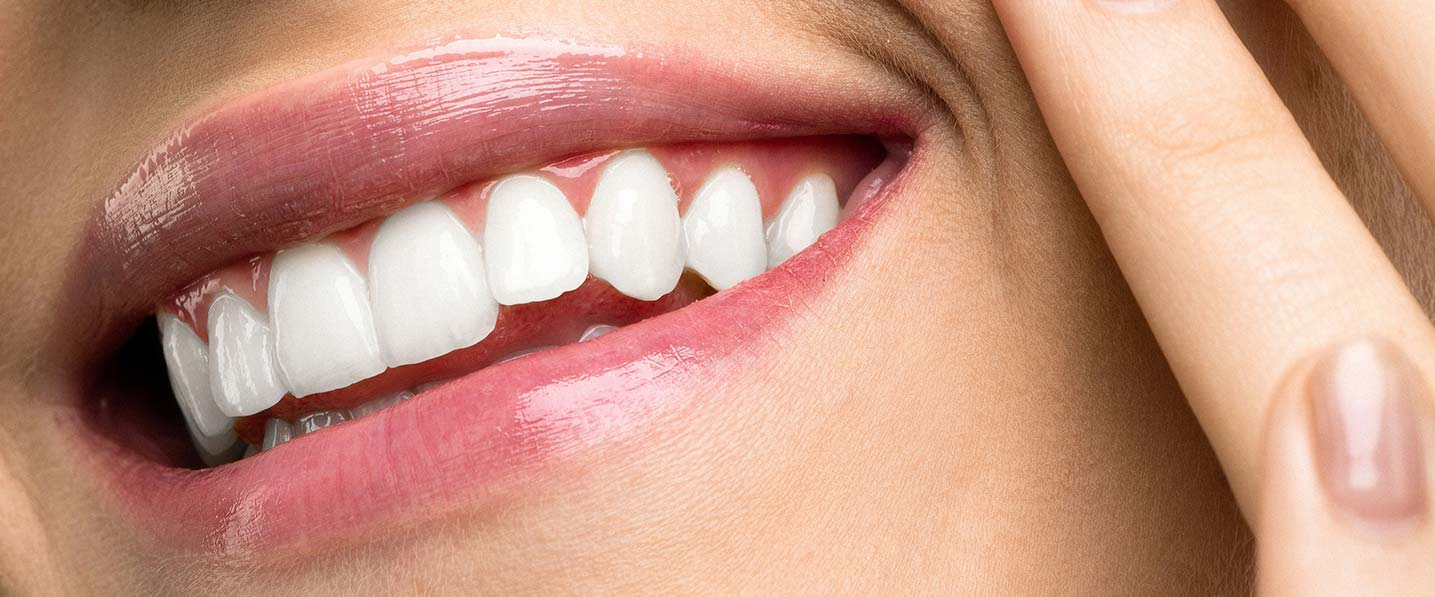 Advanced Dental Whitening | ADL